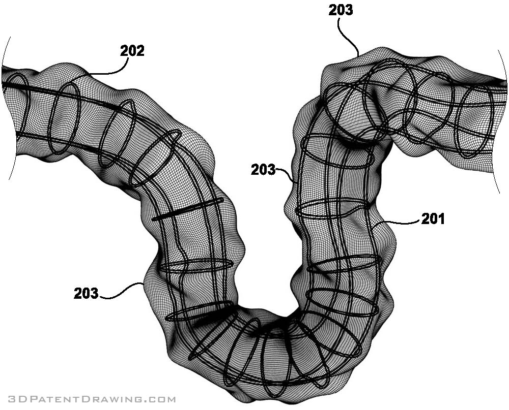 3D Patent Illustration Samples - 3D Patent Drawing